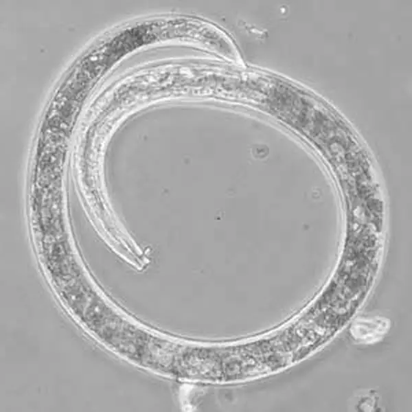 Cryptogonimidae oilasining diagnostikasi (Tsyureadan keyin, 1933 11764_1