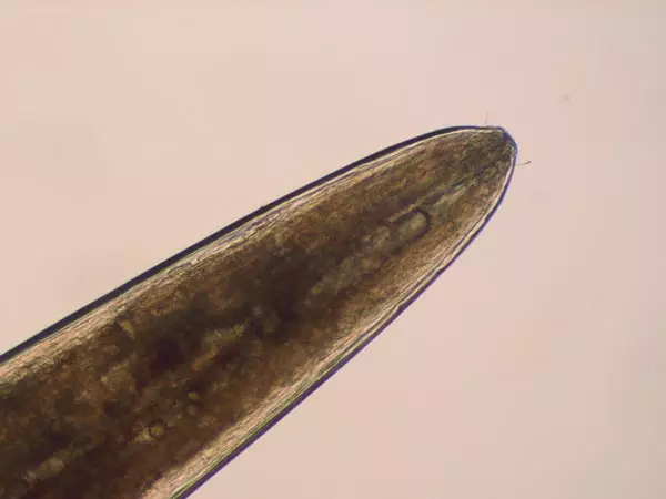 אנטומיה של Spirorchis arlericola 13160_1