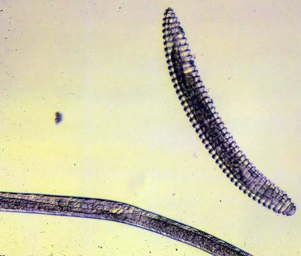 Patološki učinci Schistosoma indicum 13372_1