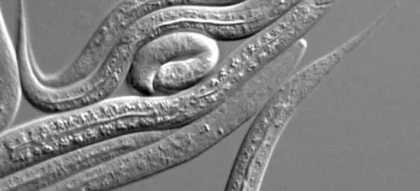 Tsarin excretory na cercariae schistosomat 13493_1