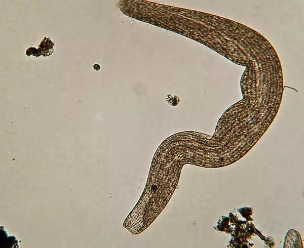 Manson schistosomiasis (အာဖရိကအူလမ်းကြောင်း schistosomiasis) 13590_1