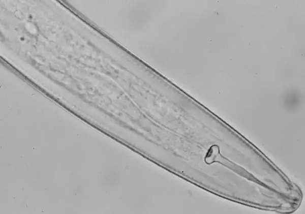 Immunologiska reaktioner vid schistosomatidos 13717_1