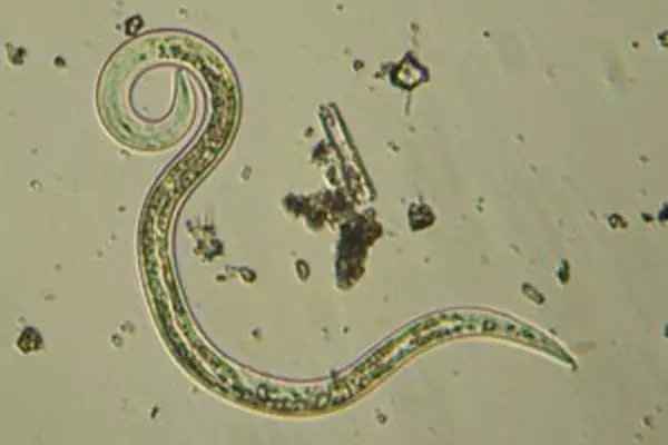 Anatomie de Phyllodistomum simile 14512_1