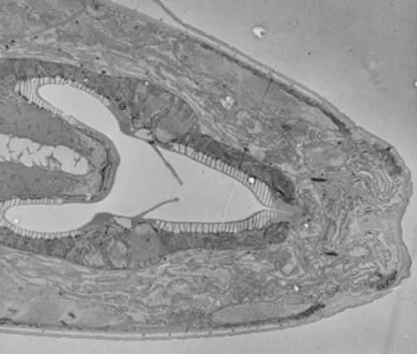 Anatomie van Stephanostomum longisomum 14815_1