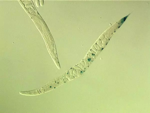 Stephanostomum sp. (Јамагути, 1934) Скрјабин, 1954 година 14861_1