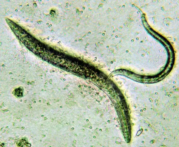 വിവരണം Sclerodistomum diodontis 17517_1