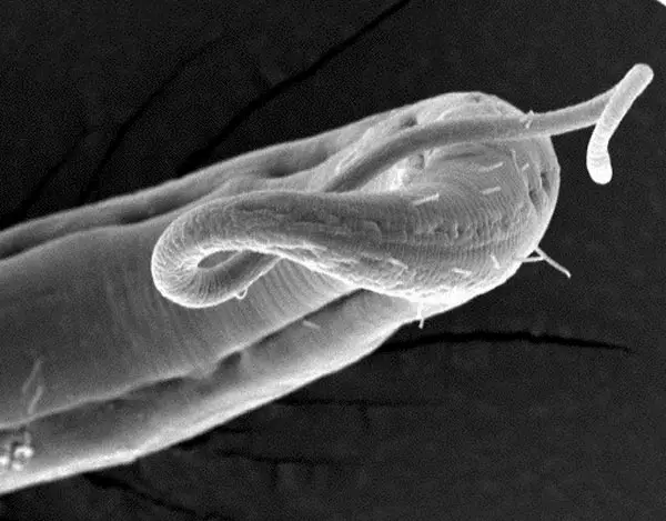 Beschreiwung vun de morphologesche Charakteristike vu Strigeididen 19022_1