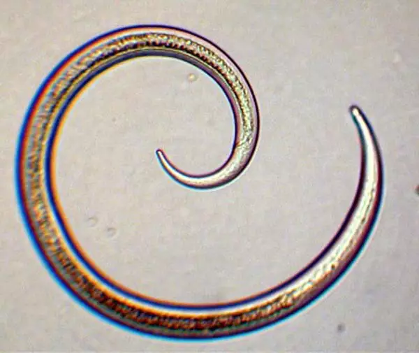 Relationship between the primary and secondary excretory systems of strigeidids 19102_1