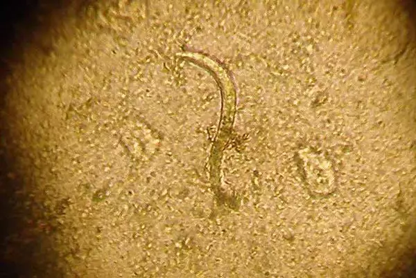 الإمراضية للميتاسركاريا Posthodiplostomum cuticola 19751_1