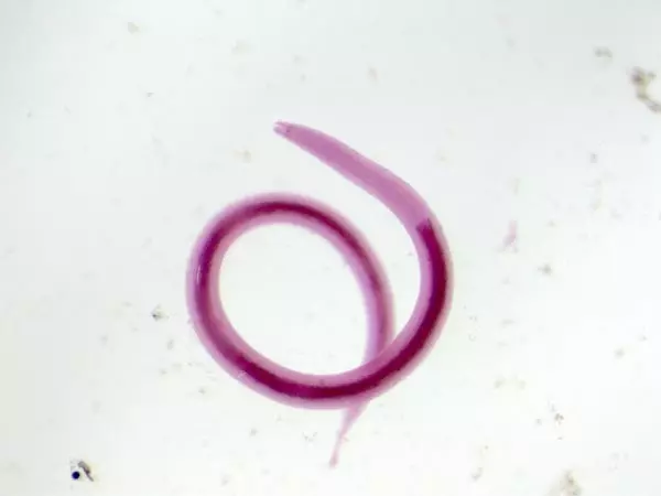 Anatomy of Scolopacitrema cubrensis 19817_1