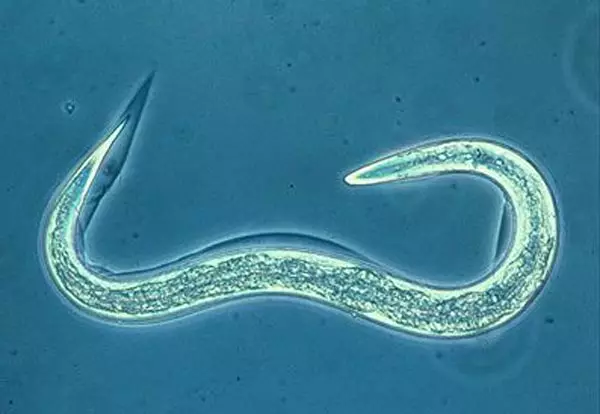 Anatomy of Allocreadium nicolli 21765_1