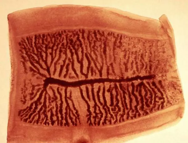 Bovine Bandworm Entwécklung