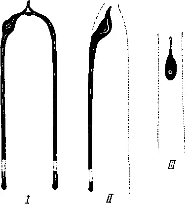 Excretory system of nematodes