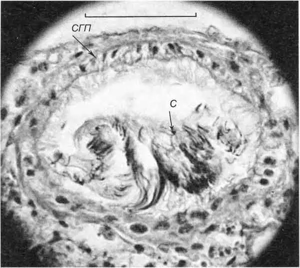 Cincinna macrostoma (Steenbuch) (D 6.1 mm; 07.26.2004): cross section sa pamamagitan ng hermaphroditic duct