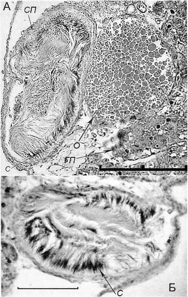 Cincinna macrostoma (Steenbuch) (A - D 6.1 mm; 07.26.2004; B - D 6.0 mm; 07.26.2004): mga seksyon ng krus sa pamamagitan ng seminal vesicle