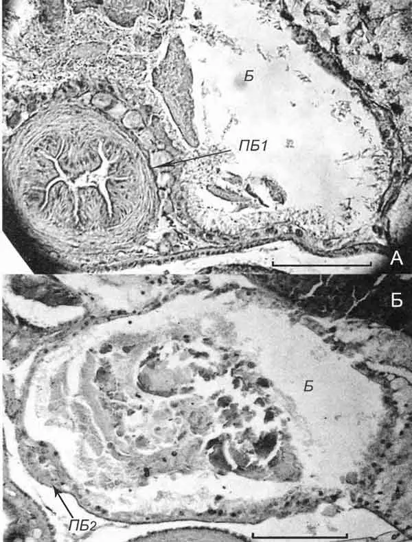 Cincinna macrostoma (Steenbuch) (D 6,1 mm; 26.07.2004): transversaj sekcioj tra la distala (A) kaj ĉefa (B) areoj de la burso