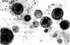 Micobatteriosi (Mycobacterium)