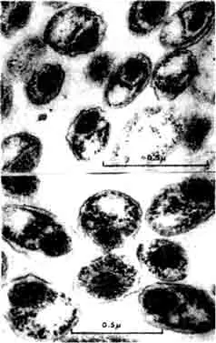 Epitheliocystis (Epitheliocystis)