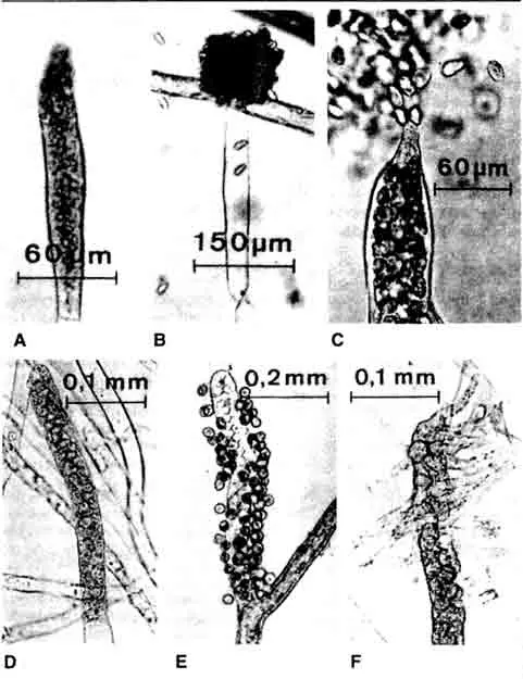 Saprolegniaceae perekonna eosed mitmel kujul: